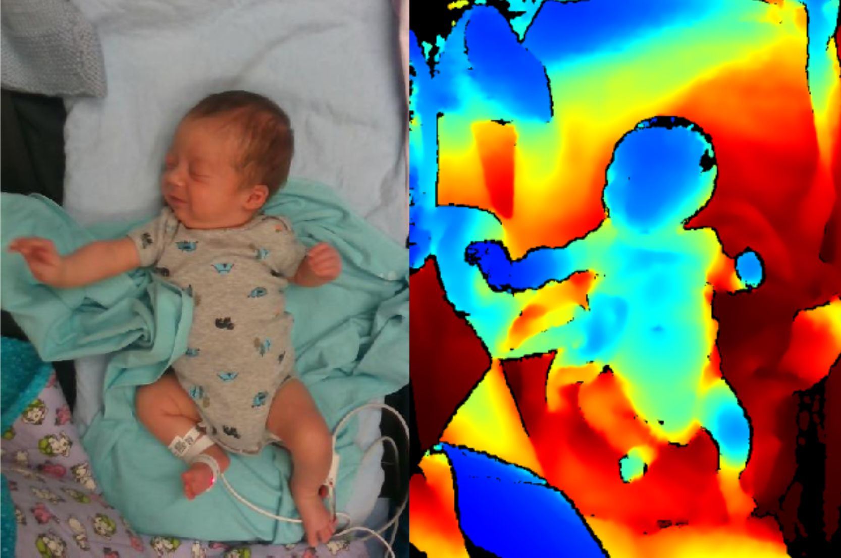 Revolutionizing Neonatal Care: Innovations in NICU Patient Monitoring ...